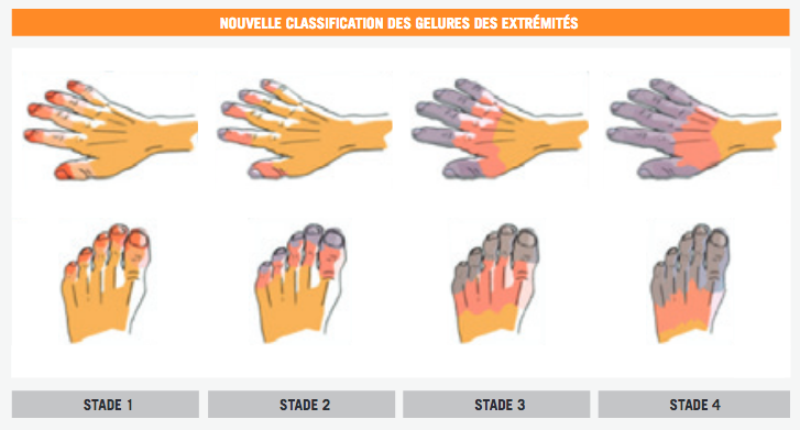 Comment éviter les engelures quand les températures chutent